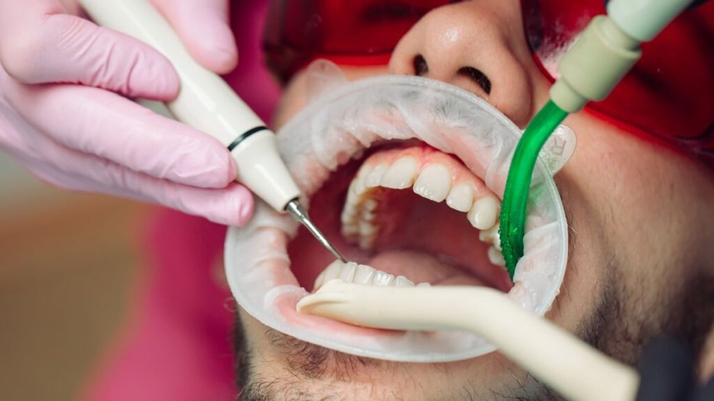 Why Teeth Turn Yellow With Age And How To Reverse it? Restore Your ...